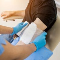 Compensation for Road Rash and Other Skin Injuries